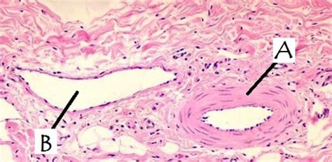 Lab 14 Blood Vessels Models Histology Flashcards Quizlet