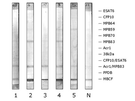 Protein A Protein G And Protein A G Selection Guide Rockland
