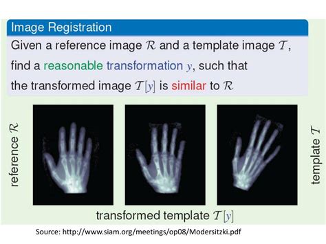 Ppt Some Applications Of Gpu Based Medical Imaging Powerpoint