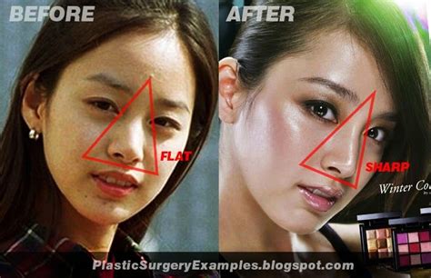 Plastic Surgery Examples Kim Tae Hee Plastic Surgery Before After Plastic