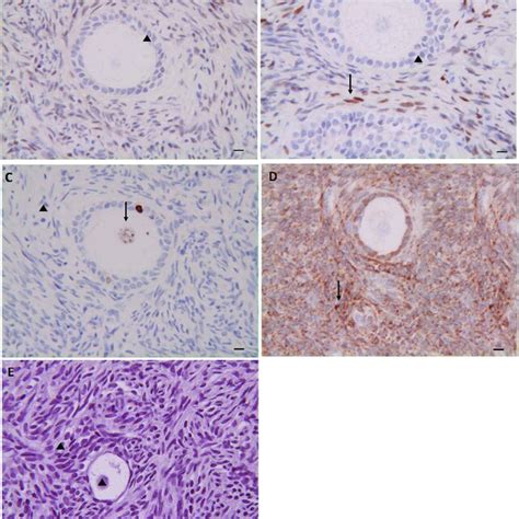Histological Analysis A Morphological Appearance Of Follicles And Download Scientific