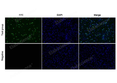 11 Search Results For Cell Proliferation And Cycle Page Elabscience®