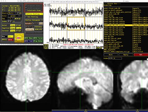 Chapter Checking Preprocessing Andy S Brain Book Documentation