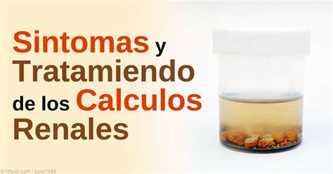 Sintomas Y Tratamiendo De Los Calculos Renales