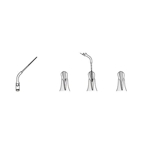 Insert Dentaire E4d Compatible Ems Insert Dentaire