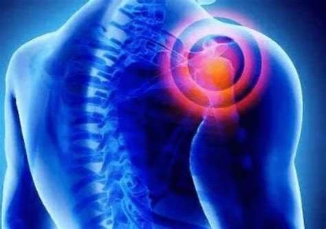 体检莫名查出“肺癌”？医生惋惜：身体3处疼痛早已给过“警报”