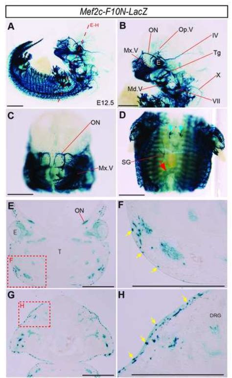 Mef2c F10n Lacz Expression Pattern Corresponds To Pns And Melanocyte