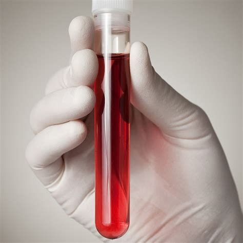 CBC Complete Blood Count With Differential Platelet Count Test Smartly Labs