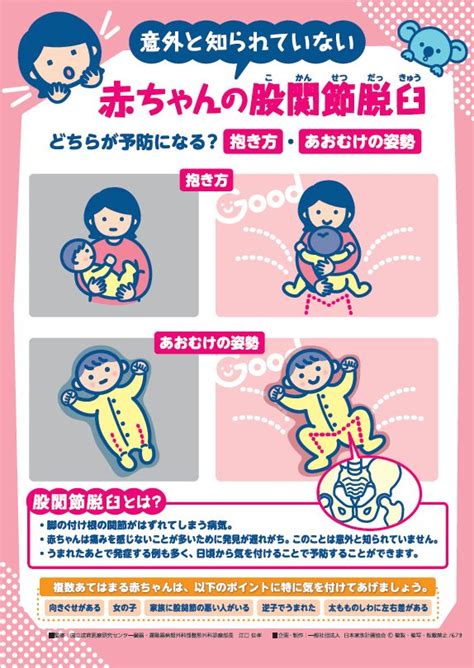 赤ちゃんの股関節脱臼 Jfpa®オンラインショップ