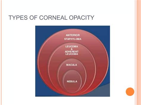 Corneal Opacity Pptx