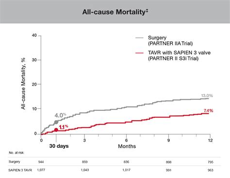 经导管主动脉瓣置换术（tavr） Edwards Lifesciences