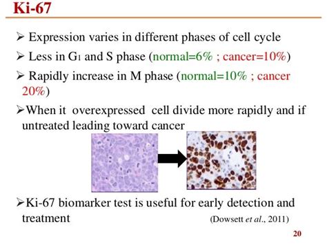 Current And Emerging Biomarkers Of Breast Cancer