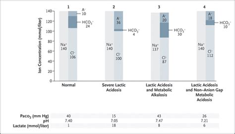 Lactic Acidosis Nejm