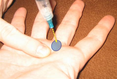 Best Practices Regional Blocks