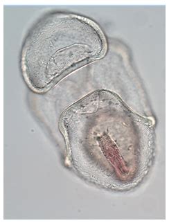 Invertebrate Embryology Asteroid Bipinnaria Larva