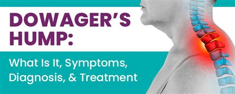 What Is Cervical Kyphosis Symptoms Causes And Treatment 47 Off