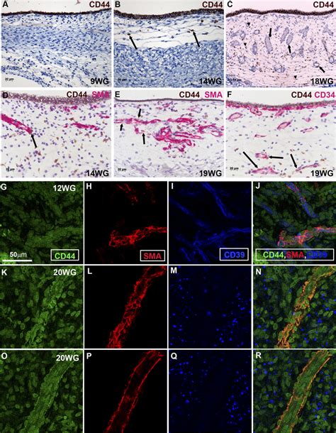 Cd44 Hematopoietic Stem Cells Give Rise To Both Mural Cells And