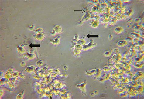 Dcs Under A Light Microscope Microscopic Features Of Day 7 Download Scientific Diagram