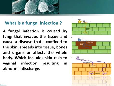 Immune Response To Fungal Infection Ppt