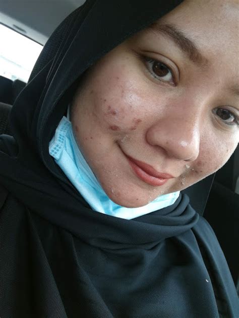 Pencuci Muka Untuk Kulit Berminyak Dan Sensitif Pilih Jenis Water