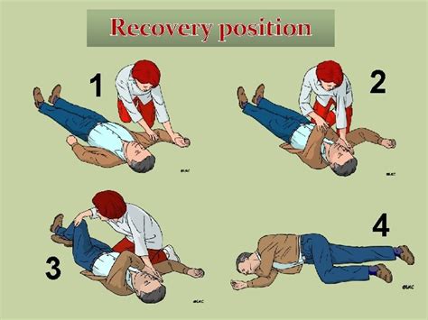 1 Basic Life Support Bls Automated External Defibrillation