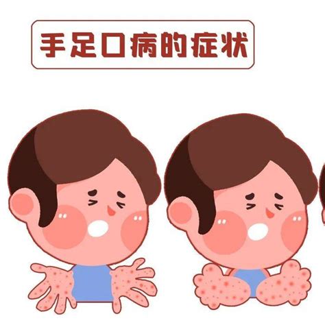 【健康科普】夏季是传染病的多发季节，请您注意以下5种疾病！接种流感疫苗