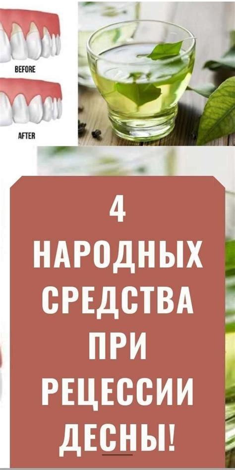 4 народных средства при рецессии десны! в 2024 г | Здоровье, Журнал о ...