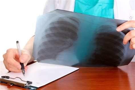 Premium Photo Doctor Describes Radiograph Patient Isolated On White