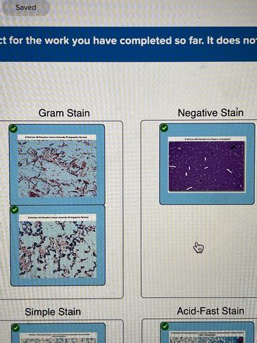 Micro Quiz Flashcards Quizlet