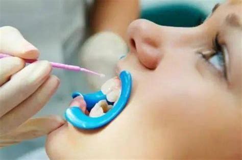 儿童口腔健康从齿开始 搜狐大视野 搜狐新闻