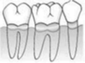 Periodontal Surgery Flashcards Quizlet