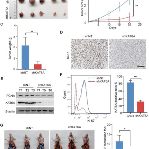 Knockdown Of Kat6a Suppresses Ovarian Tumor Growth In Vivo A