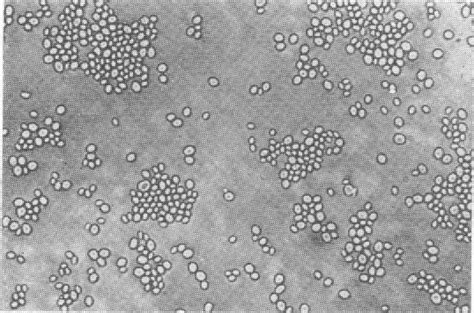 Figure 2 From Laboratory Identification Of Torulopsis Glabrata Typical