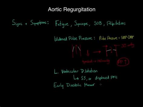 Aortic Regurgitation Symptoms And Signs