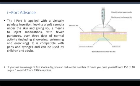 Insulin Delivery Methodspptx