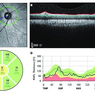 Diagrammatic Map Revealing The OCT Examination Of Participants In The Download Scientific