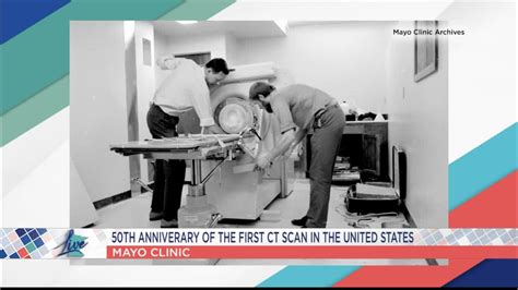 50th Anniversary Of North Americas First Ct Scan At Mayo Clinic Kstp
