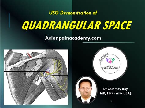 Ultrasound Guided Identification Of Quadrangular Space Live Demo
