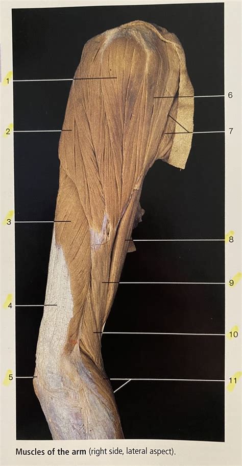 Cadaver Muscles Of The Arm Superficial Right Diagram Quizlet
