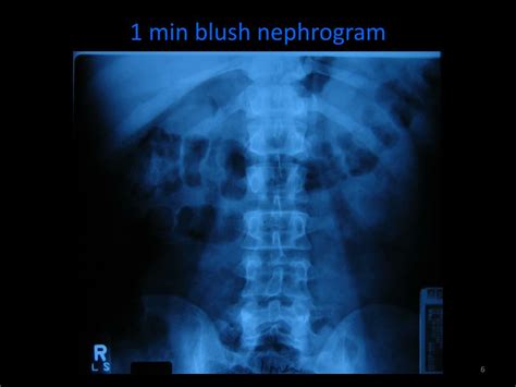 Ppt Lab Positioning For Gu System Ivp And Cysto And Ercp Powerpoint Presentation Id 3202048