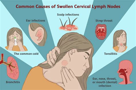 Neck Mass Symptoms Types Treatment Malignant And Non Malignant Neck Lumps Science Online