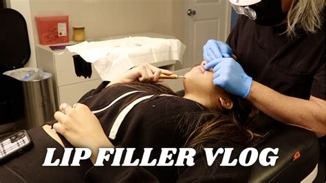 Getting Lip Filler Vlog Gone Wrong Youtube