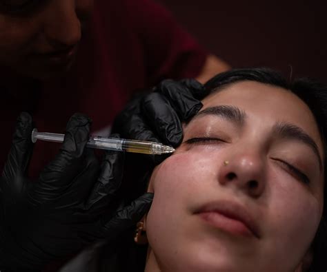 Prp Under Eye Rejuvenation • Elinea