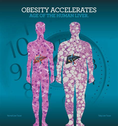 Using A Novel Biological Clock Ucla Researchers Find That Obesity