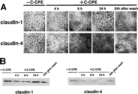 Clostridium Perfringens Enterotoxin Semantic Scholar