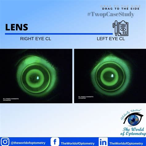 Onyinye Atueyi Posted On Linkedin