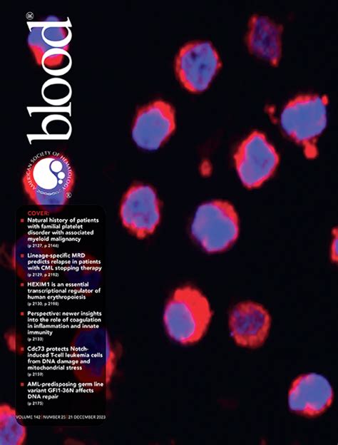 Cell Of Origin Effect Of Polatuzumab Vedotin In Diffuse Large B Cell