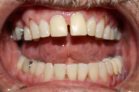 Results Gallery Mod Dentistry