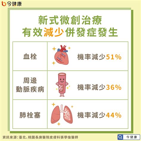 靜脈曲張可能導致肺栓塞？女性風險更高？醫：速就醫減少併發症 今健康