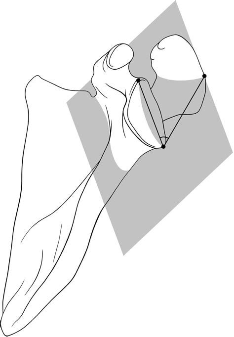 Schematic View Of The Defined Plane For The Multiplanar Reconstruction Download Scientific